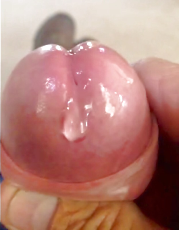 Cockhead 12 Pics Xhamster